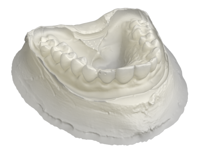 Premium Aligner Package | 3Dental